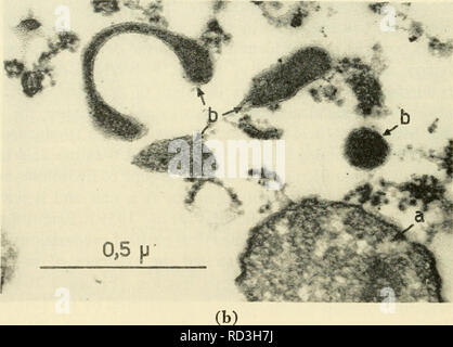 lysosome electron micrograph