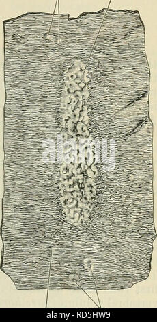 . Cunningham's Text-book of anatomy. Anatomy. Nodules of Epithelium ...