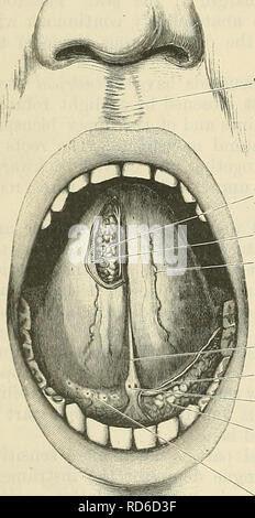 . Cunningham's Text-book of anatomy. Anatomy. genio-hyoid muscles; and ...