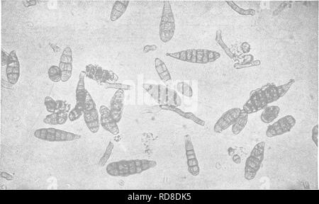 Mold filaments and spores Stock Photo - Alamy