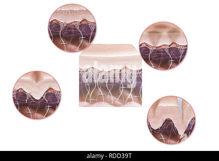 Illustration of the signs of ageing in skin, dulling of the epidermis ...