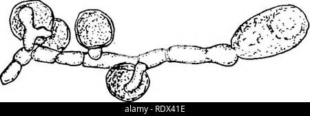 Thallus with algae in Physcia lichen. Optical microscope X100 Stock ...