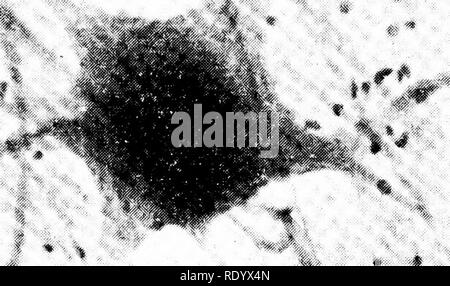 Spinal cord nerve cells, light micrograph. This tissue sample is from a ...