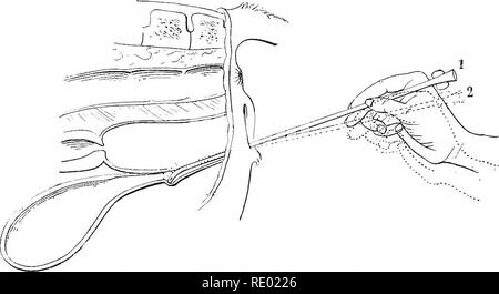 . Fig. 307.—Passing the catheter in the cow. the obstruction is about ...