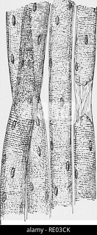 Muscle bundle made up of several largely vascularized muscle fibers ...