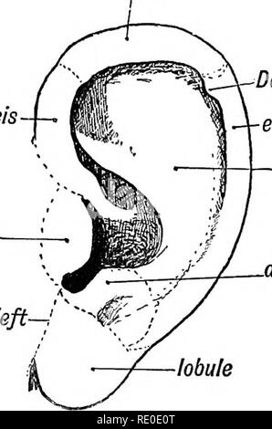 Human ear with Darwin's point Stock Photo - Alamy