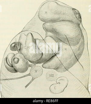 Cyclopia human Stock Photo - Alamy