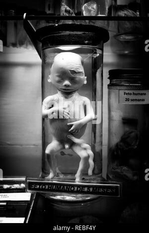 A photo of a 5 months old human fetus. The specimen is a part of ...