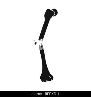 fracture,pain,bias,injury,connective,musculoskeletal,fiber,scientific ...