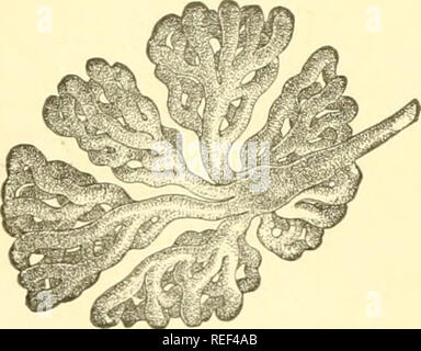 Gustatory papillae on the human tongue showing taste buds located in ...