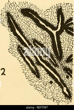 fungal hyphae and soil fungi in a soil sample, showing the living soil ...