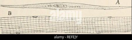 Nuclei of smooth muscle cells. These cells show a very elongated ...