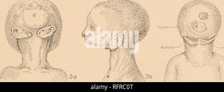 Human Embryo, External Ear Development Stock Photo - Alamy