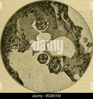 Cross section of ascaris Stock Photo - Alamy