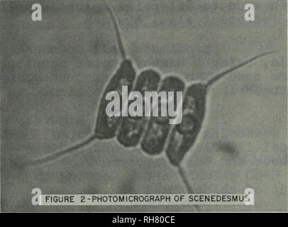 Large, single-celled algae cells of the genus Halosphaera (probably H ...