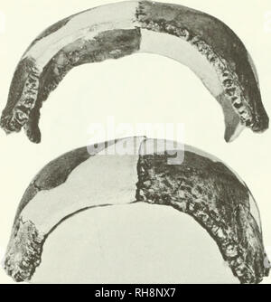 Human brain from above and below. 3D magnetic resonance imaging (MRI ...