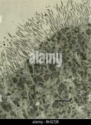 Mitochondria. Transmission electron micrograph of mitochondria from ...