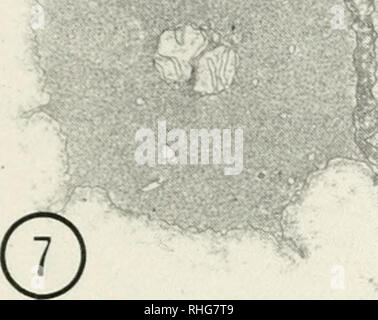Nuclei of smooth muscle cells. These cells show a very elongated ...