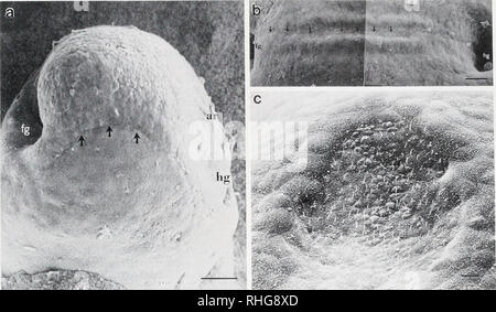 Mouse embryo. Scanning electron micrograph (SEM) of a sagittal ...