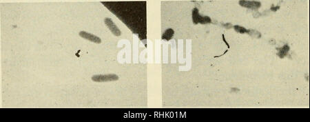 Escherichia Coli (E. Coli.) cells or bacteria under microscope Stock ...