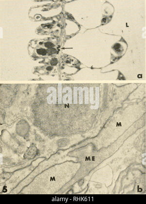 Hydra, light micrograph. Cross-section of the body showing the two ...