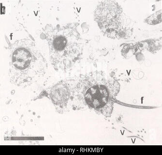 Sperm cell, TEM Stock Photo - Alamy