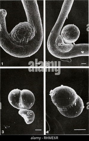 Egg cup in shape of broken egg shell with two human legs. Kitsch ...