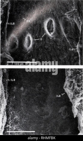 Scanning electron micrograph of the inner surface of a pupal case, or ...