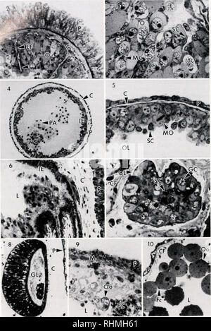 Primary oocyte, light micrograph. A primary oocyte in an antral ovarian ...