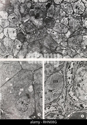 Plasma cells, light micrograph Stock Photo - Alamy