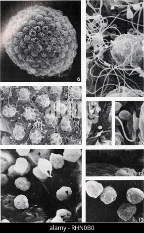 Scanning electron micrograph (SEM) of a laboratory-grown potable water ...