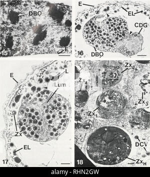 Light micrograph in phase contrast illumination of the ciliate ...