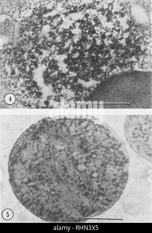 Light micrograph of a section through thick dermis from human skin ...
