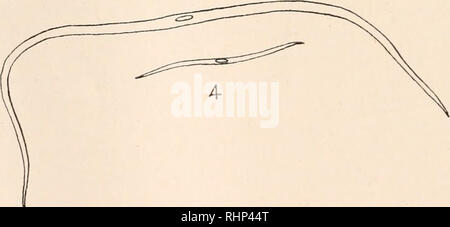 Muscle fiber showing the myofibrils made up of myofilaments (actin and ...