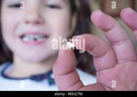 The little girl lost a tooth. Loss of the first tooth in a child Stock ...