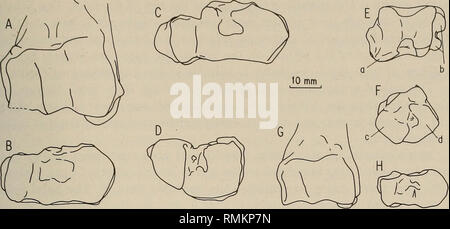 Illustration of the tibia. This anterior view illustration is from ...