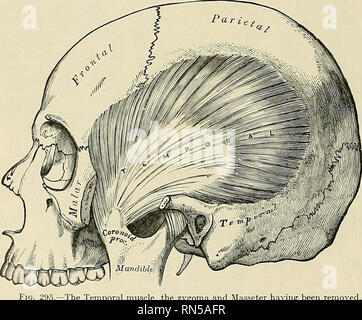 Fascia Temporal Temporoparietal Fascial Flap In Orbital Reconstruction