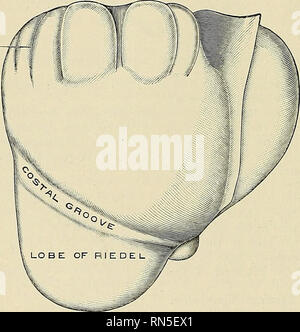 . Anatomy, descriptive and applied. Anatomy. THE COMMON CAROTID ARTERY ...