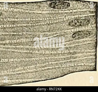 Nuclei of smooth muscle cells. These cells show a very elongated ...