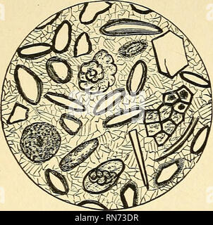 Fossils in limestone Thin section under the microscope 100x Stock Photo ...