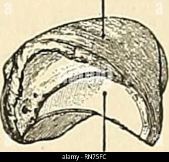 . Anatomy, descriptive and applied. Anatomy. -HEAD OF DORSAL HORN BASE ...