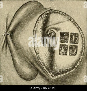 . Anatomy, descriptive and applied. Anatomy. THE SKULL AS A WHOLE 1.3:3 ...