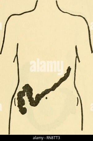 . Anatomische Hefte. über den Bau und die Entstehung der Haustra coli ...