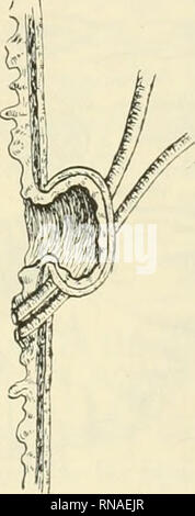 . The anatomical record. Anatomy; Anatomy. Fig. 9 Omental appendage ...