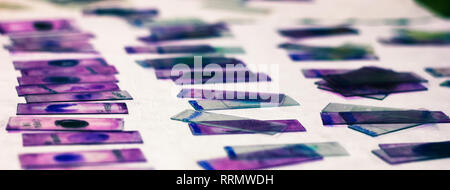 stained glass slides of peripheral blood smear with violet leishman ...