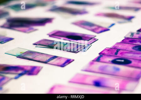 stained glass slides of peripheral blood smear with violet leishman ...
