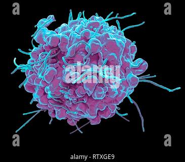 Apoptosis. Coloured scanning electron micrograph (SEM) of a brain ...