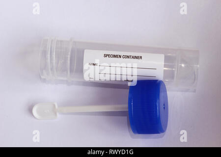 Test tube, stool sample Stock Photo - Alamy