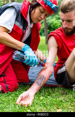 Medical worker treating burns on man's arm Stock Photo - Alamy