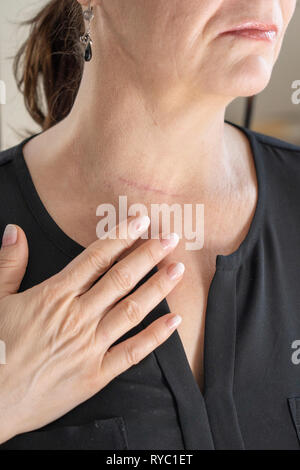 caring middle aged doctor comforting a disabled patient Stock Photo - Alamy